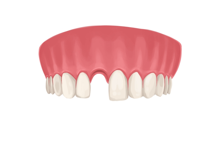 Picture by Authority Dental under CC 2.0 license