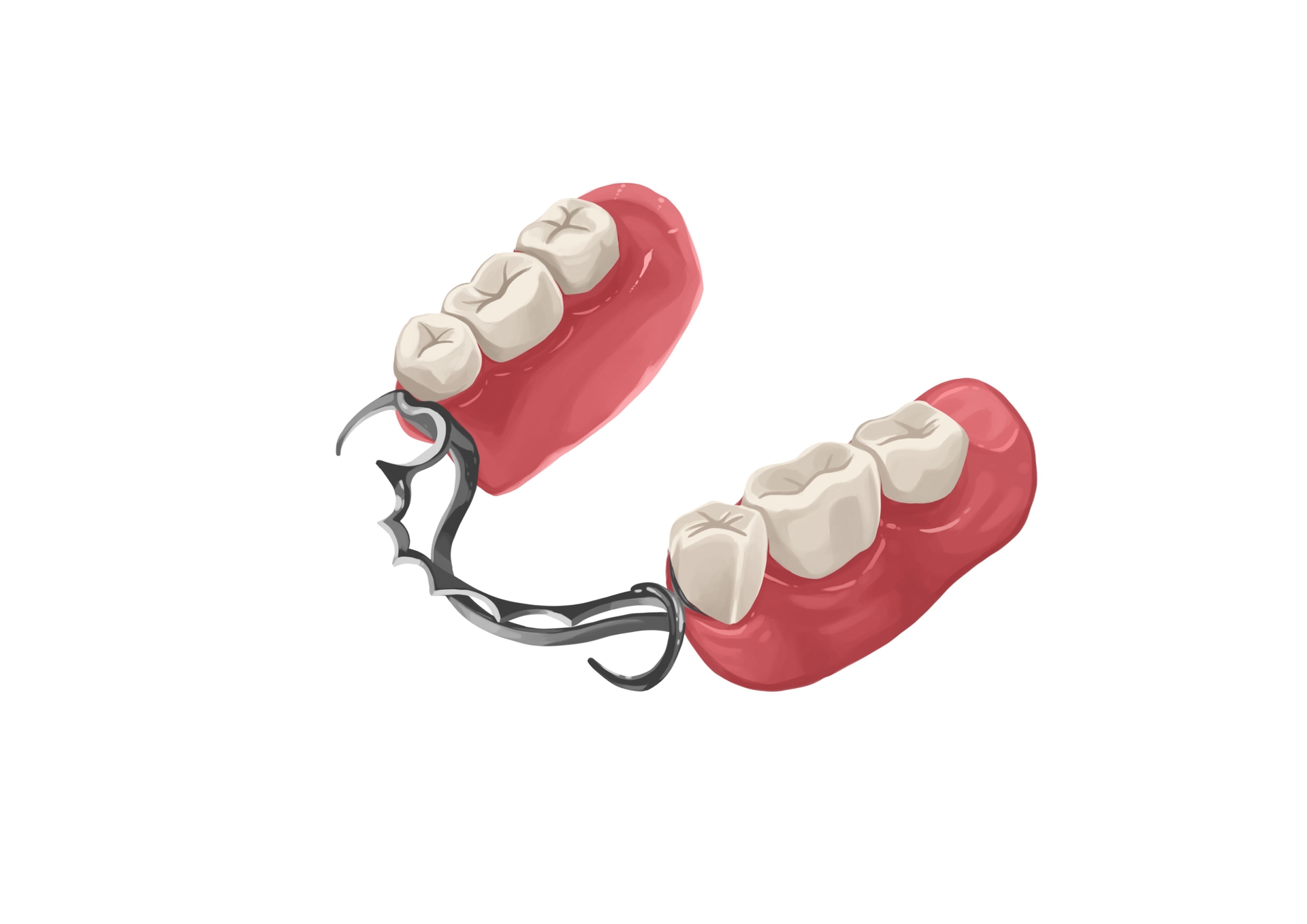 Dentures types (partial, full) and procedure | Authority Dental
