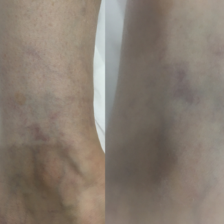 Whitby - Laser Treatments Clinic | Hair Removal, CoolSculpting & More