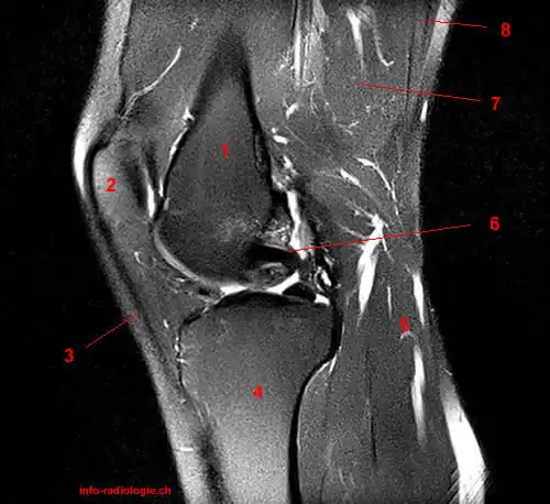 Atlas of Knee MRI Anatomy - W-Radiology