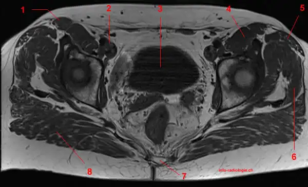 MRI of the Hip: Detailed Anatomy - W-Radiology