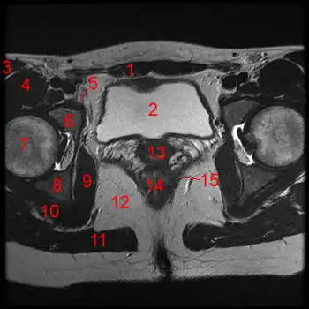 MRI of the Female Pelvis - W-Radiology