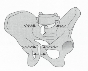 Pelvic Stability Dysfunction - The Vantage Clinic | Thame