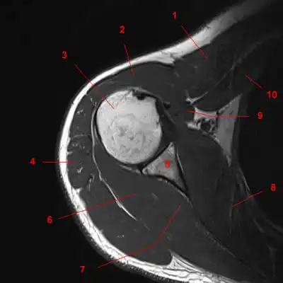Atlas of Shoulder MRI Anatomy - W-Radiology