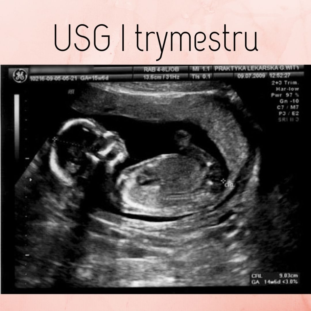 USG | szkoła rodzenia "pod sercem"