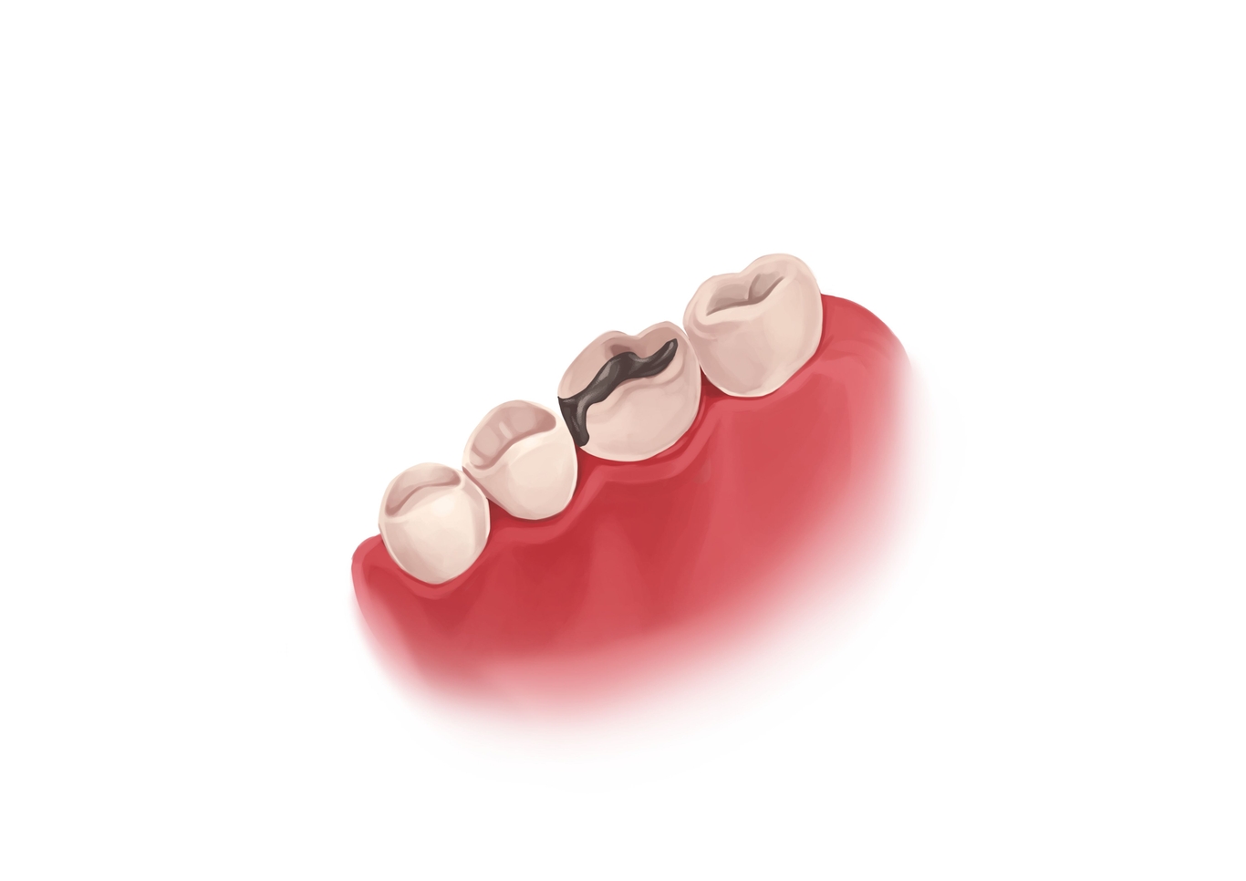 Picture by Authority Dental under CC 2.0 license