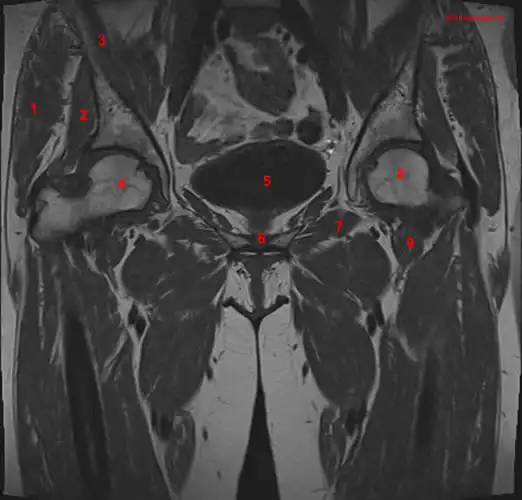 MRI of the Hip: Detailed Anatomy - W-Radiology