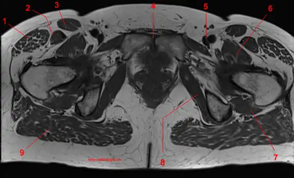 MRI of the Hip: Detailed Anatomy - W-Radiology