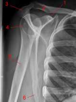 Experts agree that imaging assessment of shoulder disorders must begin ...