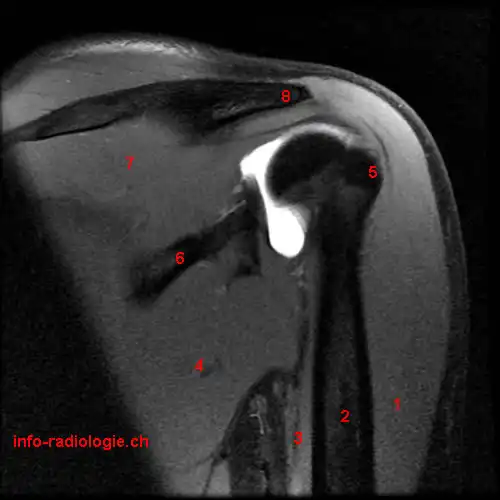 Shoulder MR Arthrography Anatomy - W-Radiology