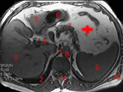 Atlas MRI Abdomen - W-Radiology