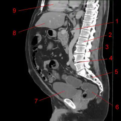 Atlas of CT Anatomy of the Abdomen - W-Radiology