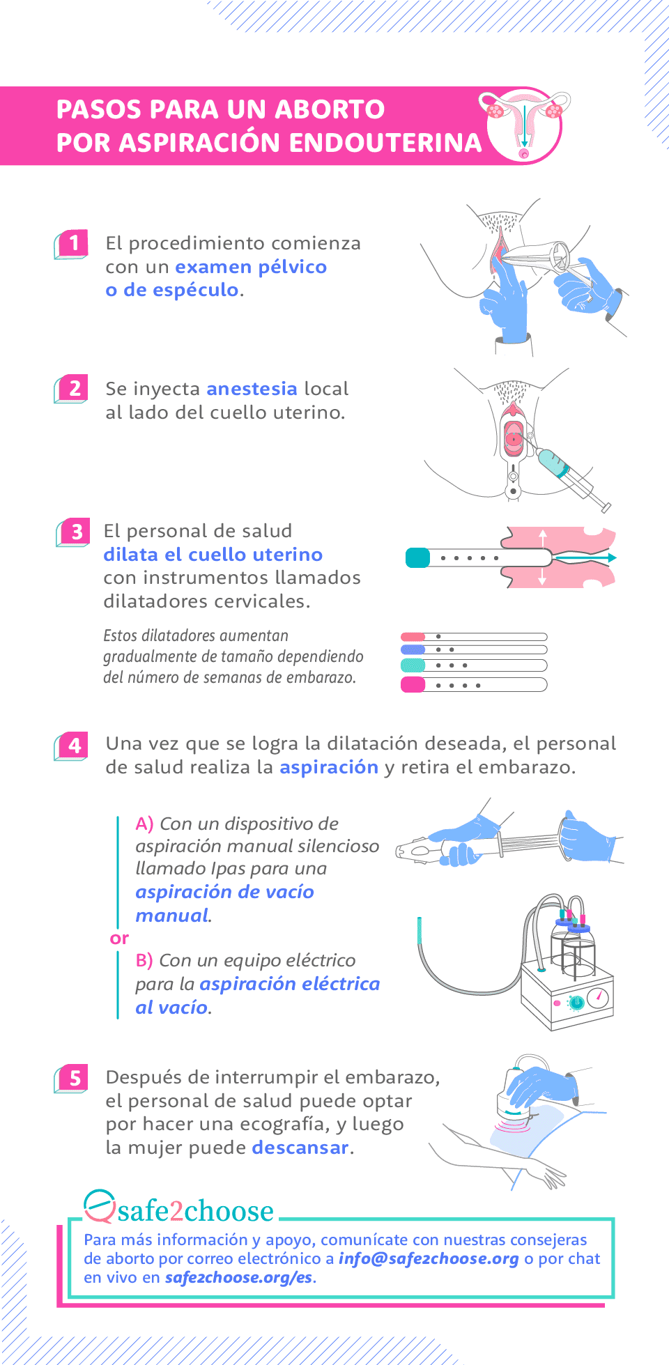 Guía de Aborto por Aspiración Manual Endouerina (AMEU) | safe2choose