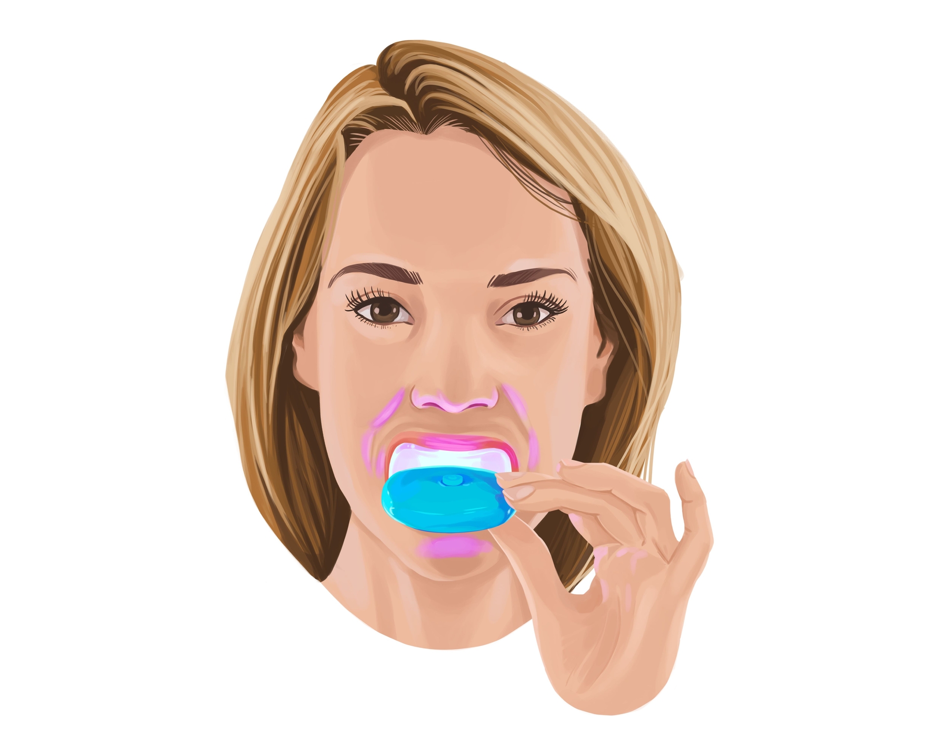 Picture by Authority Dental under CC 2.0 license