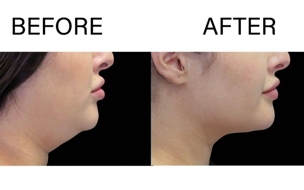 Whitby - Laser Treatments Clinic | Hair Removal, CoolSculpting & More