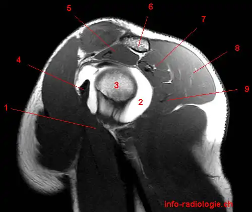 Shoulder MR Arthrography Anatomy - W-Radiology