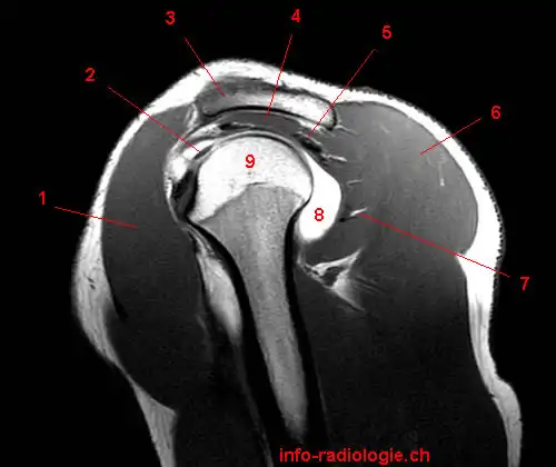 Shoulder MR Arthrography Anatomy - W-Radiology