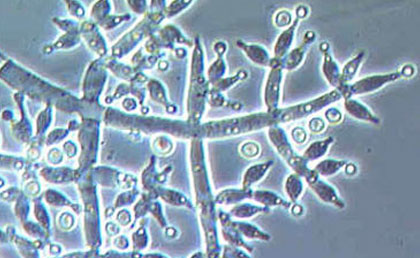 Trichoderma - Alchetron, The Free Social Encyclopedia